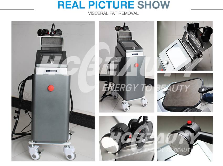 Visceral Fat Removal Equipment RET Slimming for Sale RET100