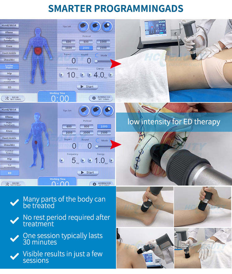 Physiotherapy Shockwave Machine